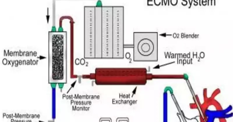What is ECMO? How does it work?