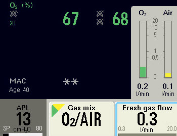 K. Scott Richey: Minimal Fresh Gas Flow: "A Reassuringly Safe ...