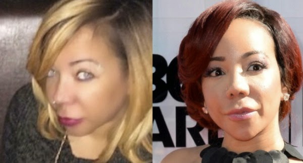 Tameka "Tiny" Harris Plastic Surgery Eyes