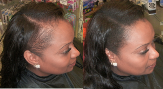 How to make your hairline & edges fuller in minutes!