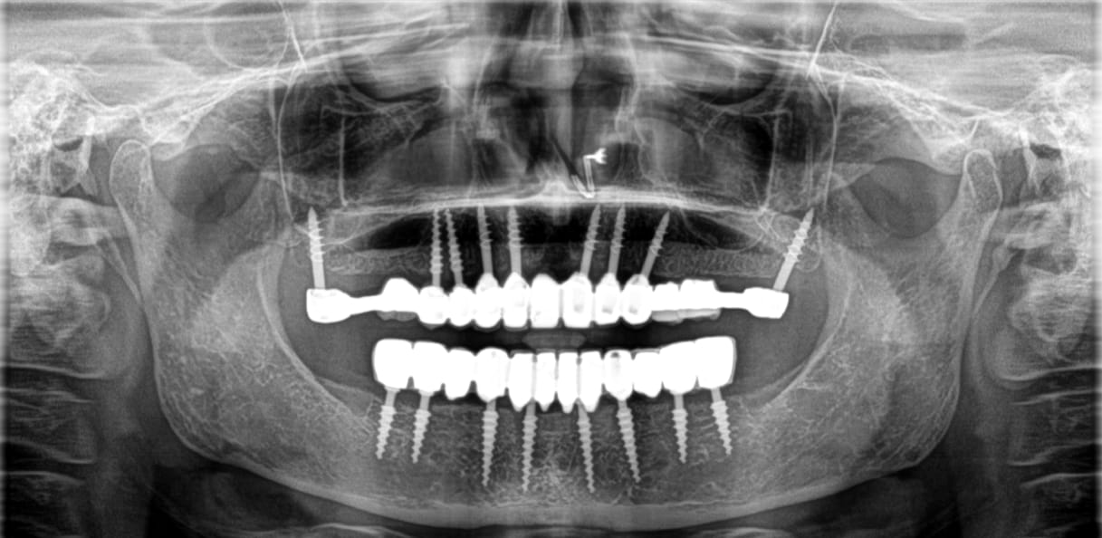 Aashirwad Dental Implant Center