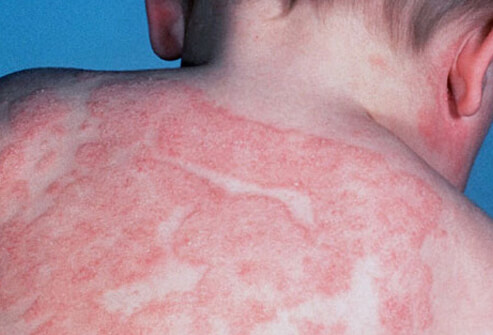 DERMATOLOGÍA : LESIONES HISTOLÓGICAS FUNDAMENTALES