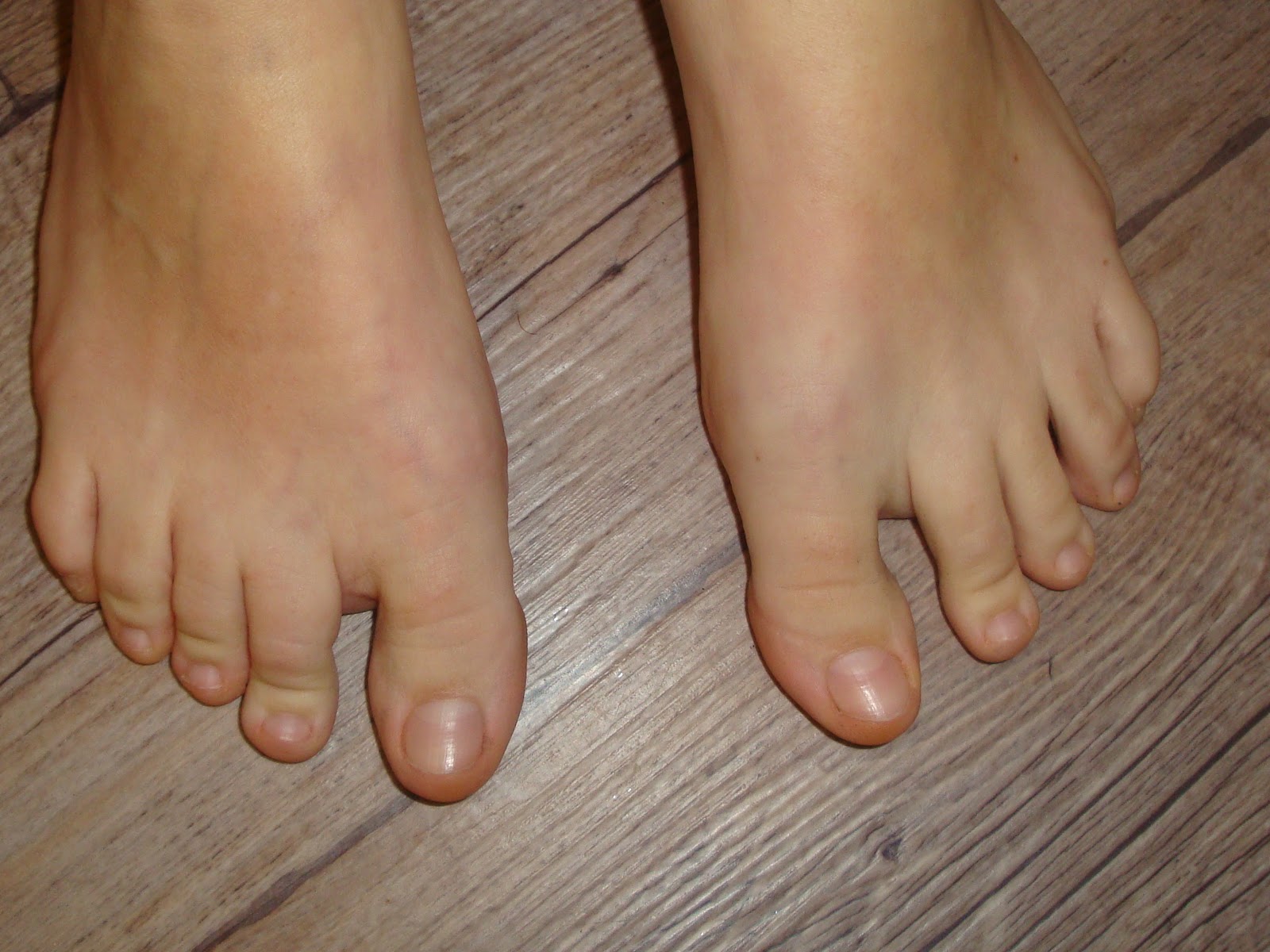 Tenen en hun verhaal - #365tenen: #dag23