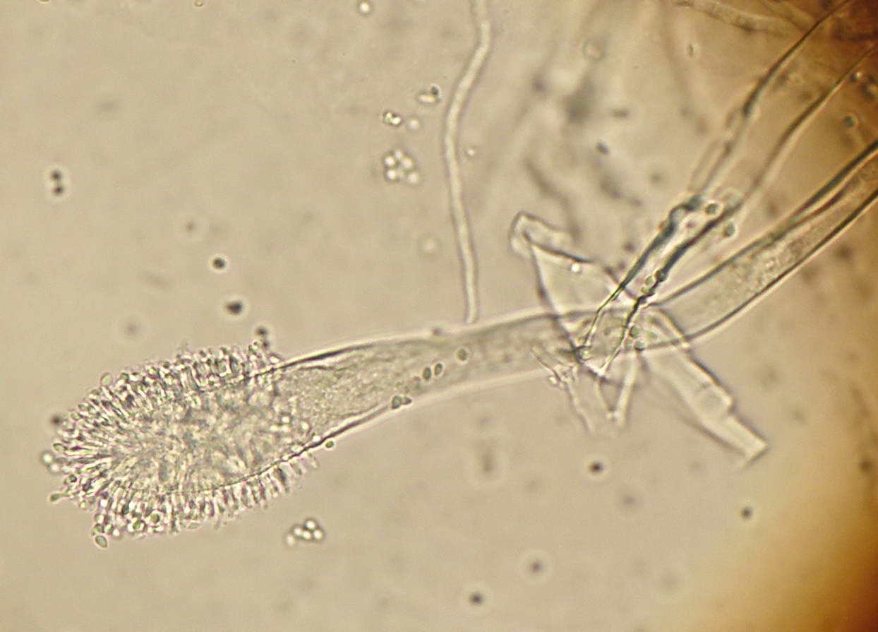 ATLAS MICOLOGIA: ASPERGILLUS CLAVATUS