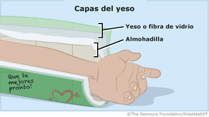 TIPOS DE MATERIALES PARA YESOS Y FERULAS: Materiales para yesos y ferulas