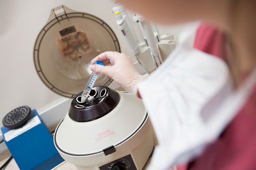The Medical Journal: What is a centrifuge and how does it work?