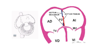 COMUNICAÇÃO INTERAURICULAR (CIA)