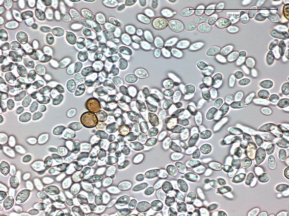 Fun With Microbiology (What's Buggin' You?): Exophiala dermatitidis