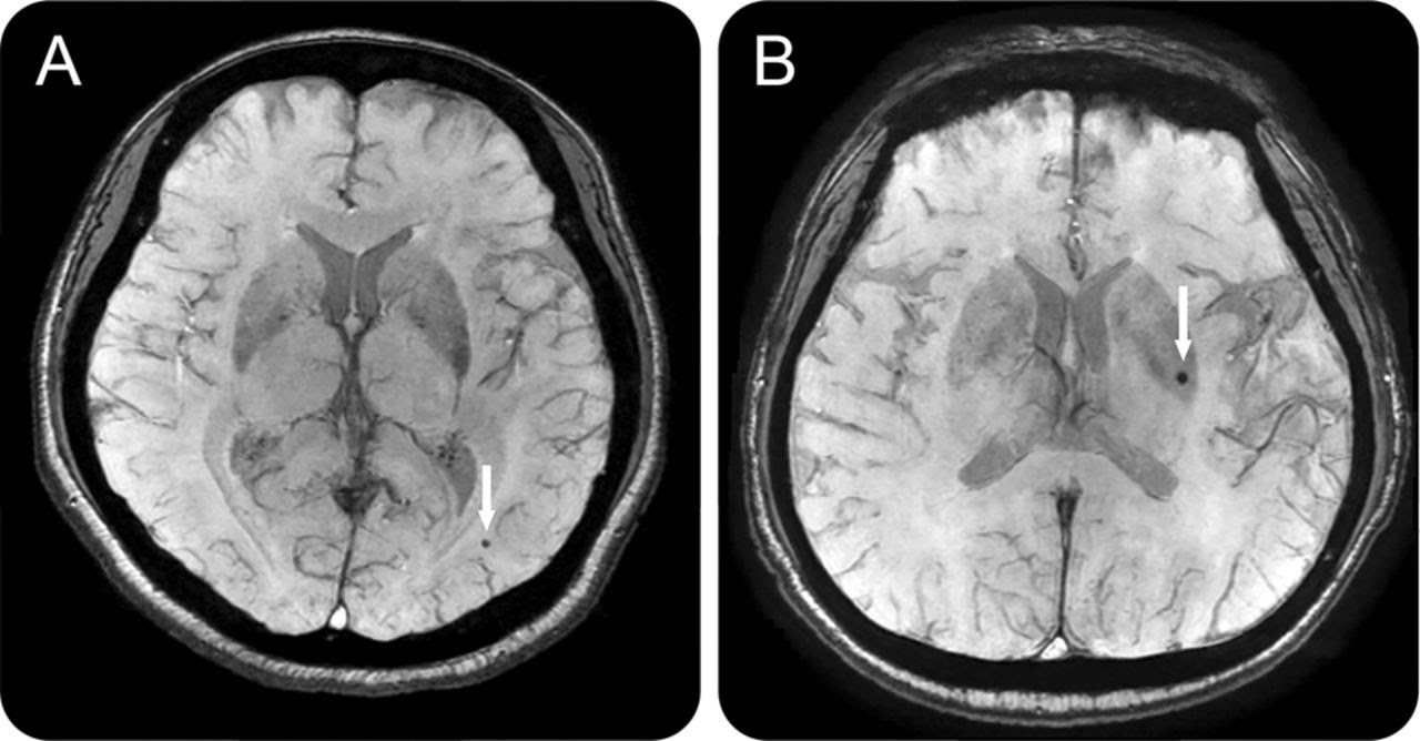 Magnetic Resonance Innovations Research Blog: 2015-04-26
