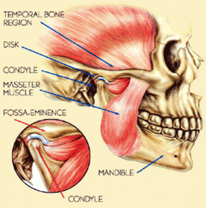 gangguan tmj: GEJALA TEMPOROMANDIBULAR DISORDER