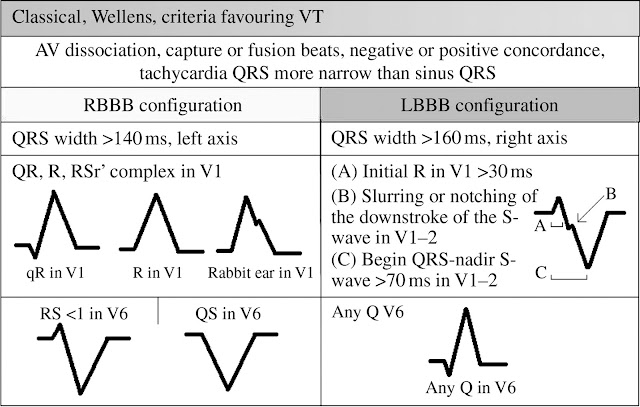 Cardiology window: SVT with aberrancy