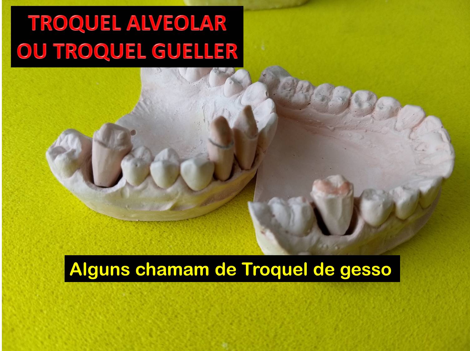 Professor Gilmar Zukowski gilmarprotese.blogspot.com : 3ºANO PF ...