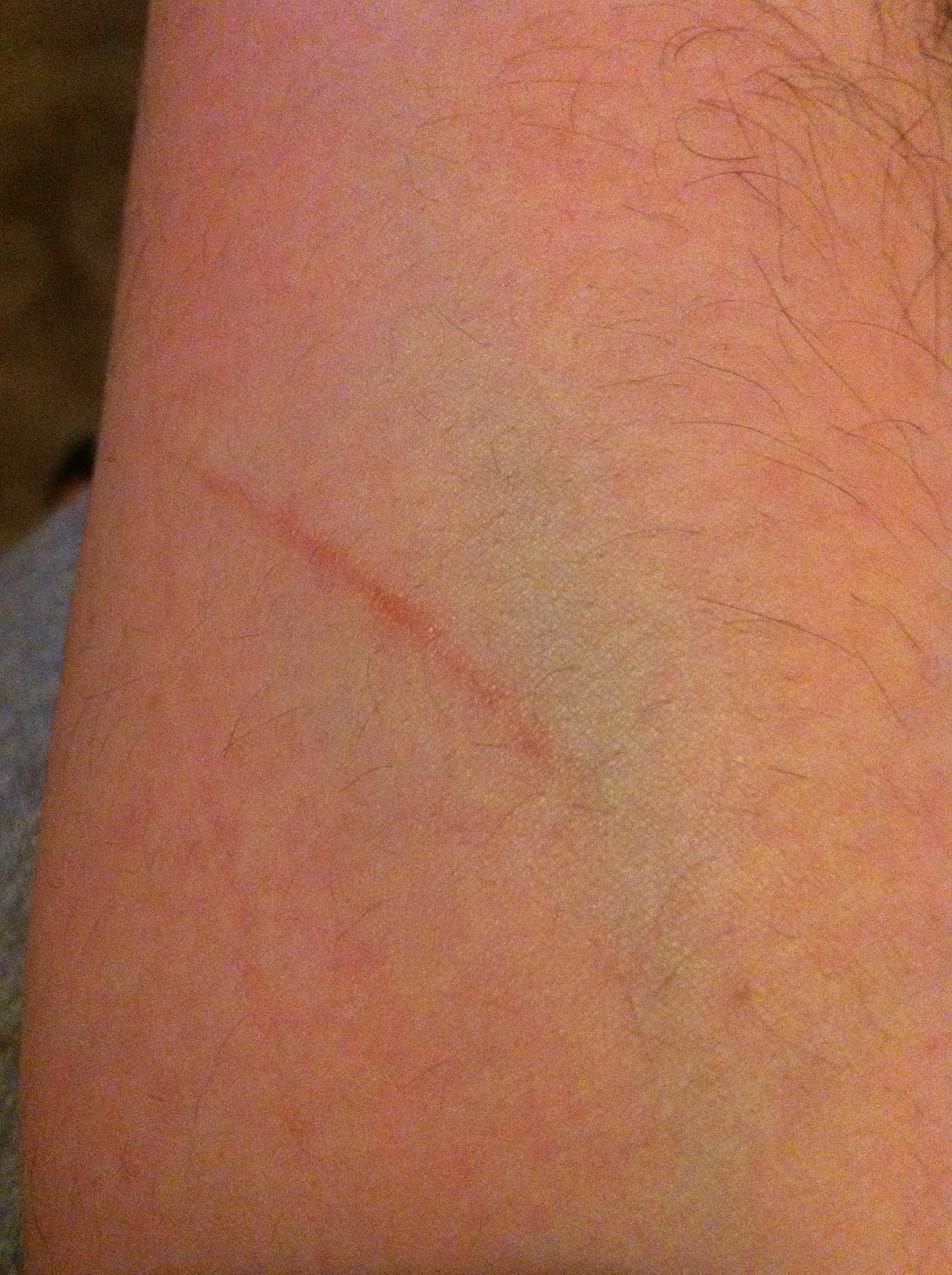 A Review A Day: Today's Review: My Right Arm