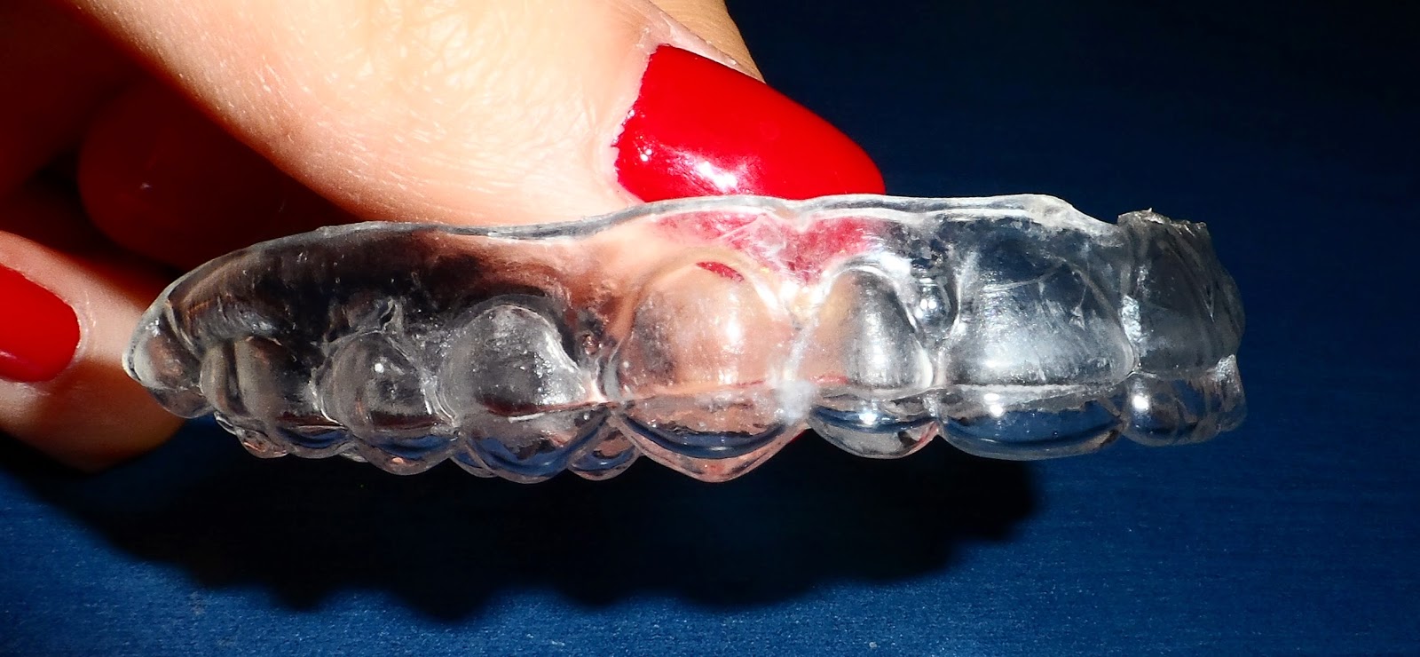 Orto druciki: Retainer