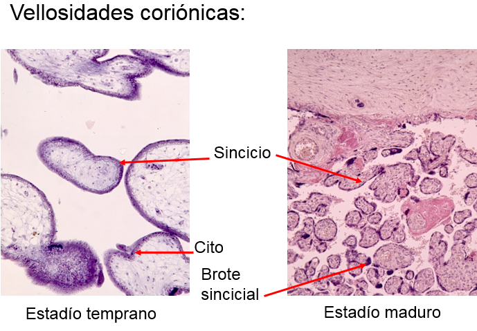 Embriología : Tercera semana del desarrollo: el disco germinativo ...