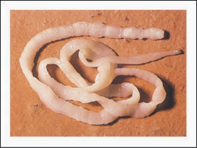 Doctores descubren: Los gusanos están invadiendo tu Cerebro por comer ...