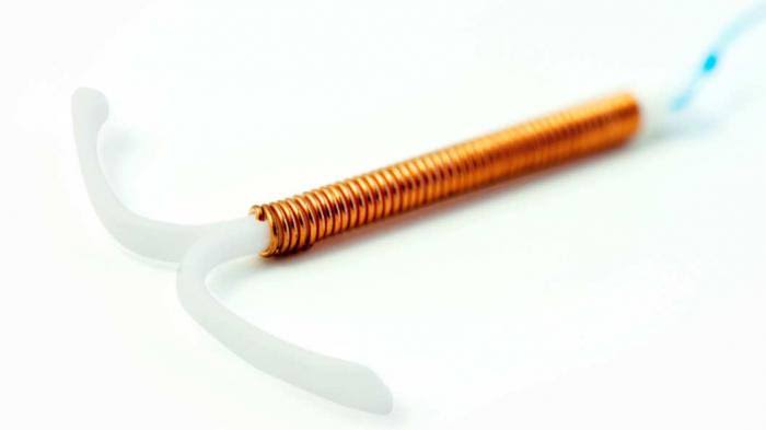 Alat Kontrasepsi IUD - Medianers