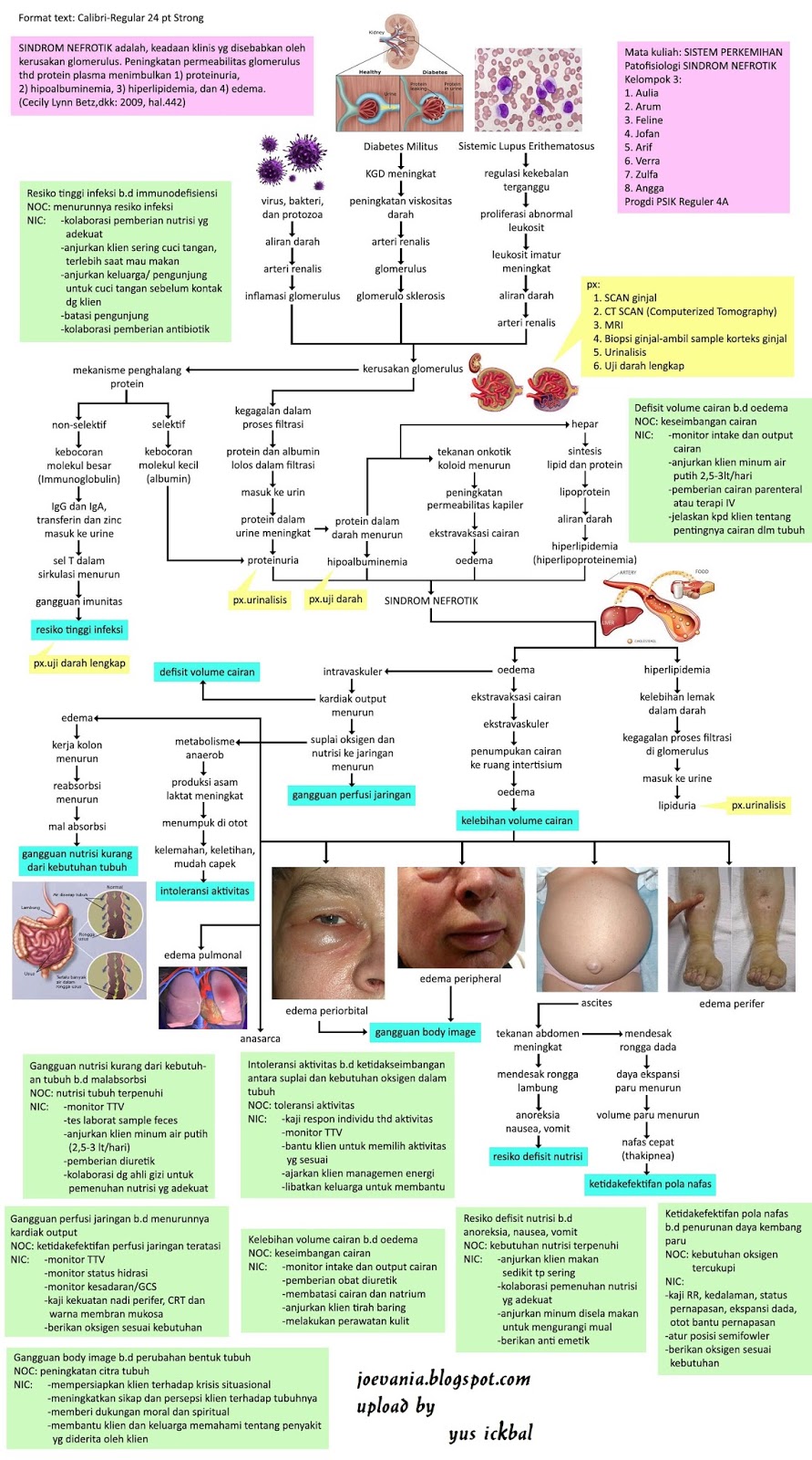 pathway sindroma nefrotik