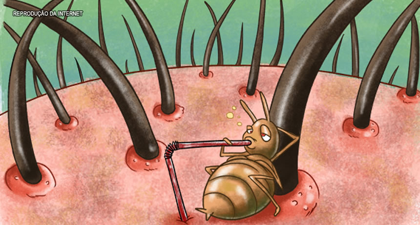 O que você sabe sobre o Piolho?