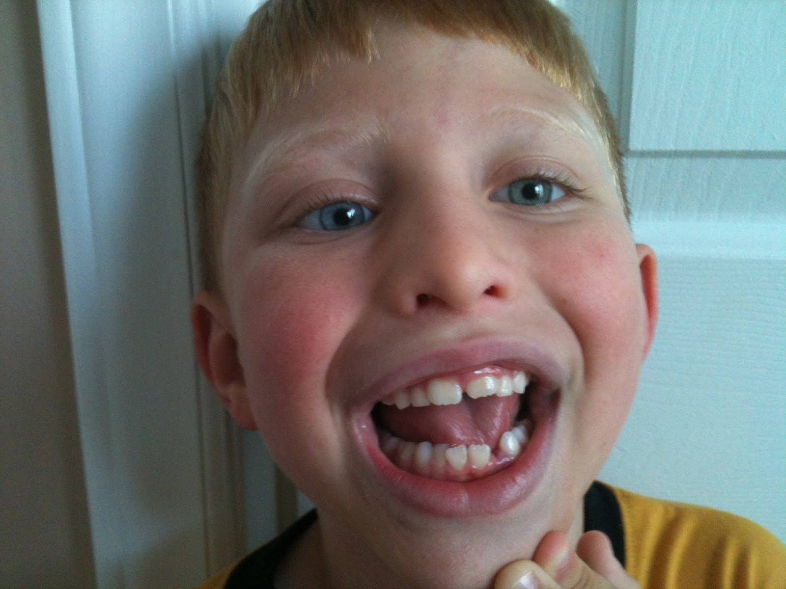 Shanna's Adventures: Jonah Lost His 5th Tooth