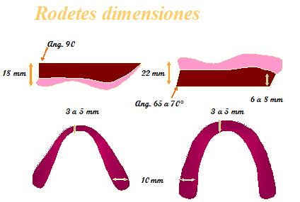 PRECLÍNICA de PRÓTESIS: Protesis Completa. Confección de rodetes
