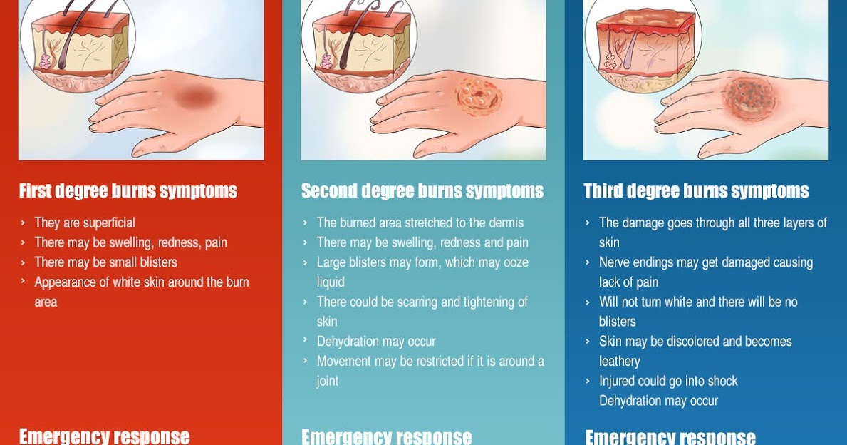 Fire Accident - Emergency Procedures ~ Kauvery Hospitals
