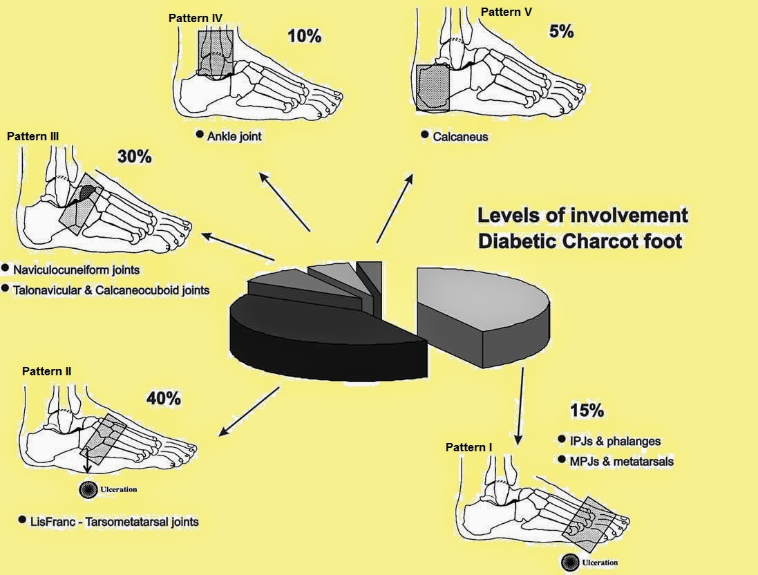 hEiDiMatEs - MeDICinE: Diabetic charcot neuroarthropathy : Classification