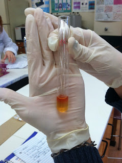 Rose & Lindsey's Medical Microbiology Blog: Methyl Red Test and Voges ...