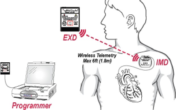 Heart attack alarm 'will save lives' - World Of Technology