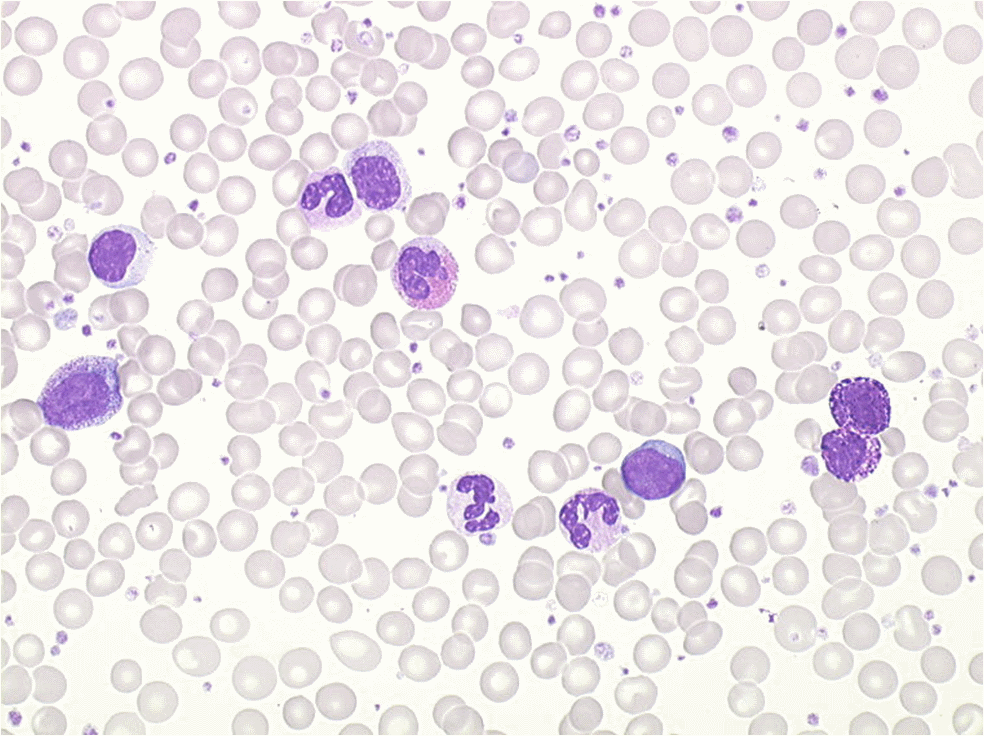 Les plaquettes sanguines - BIOLOGIE MEDICALE