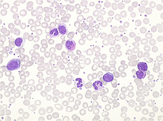 Les plaquettes sanguines - BIOLOGIE MEDICALE
