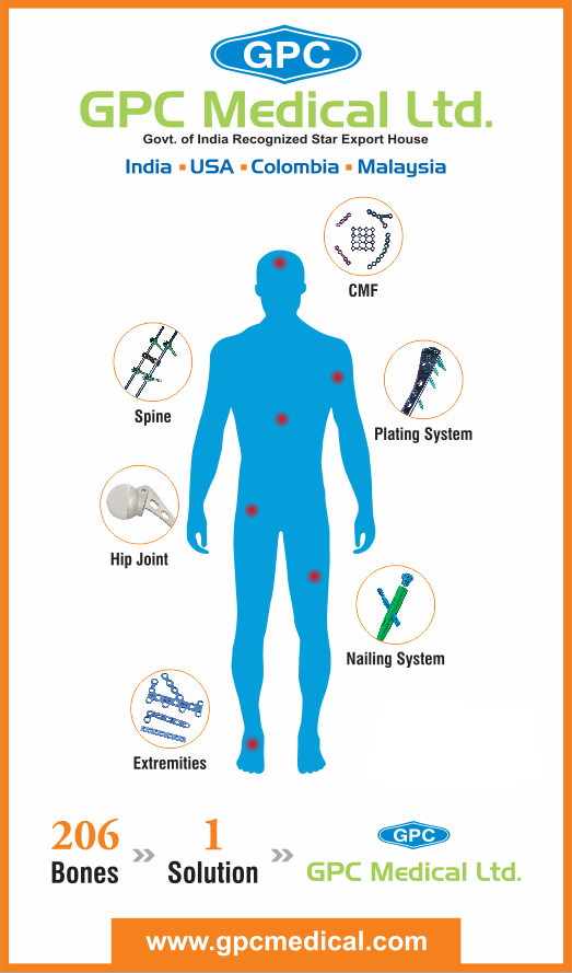 All you need to know about Orthopedic Implants