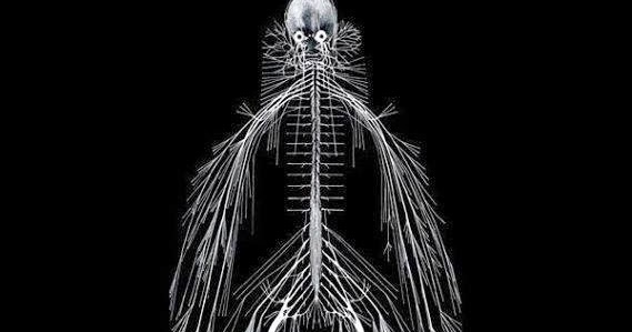 bnox: Harriet’s nerves