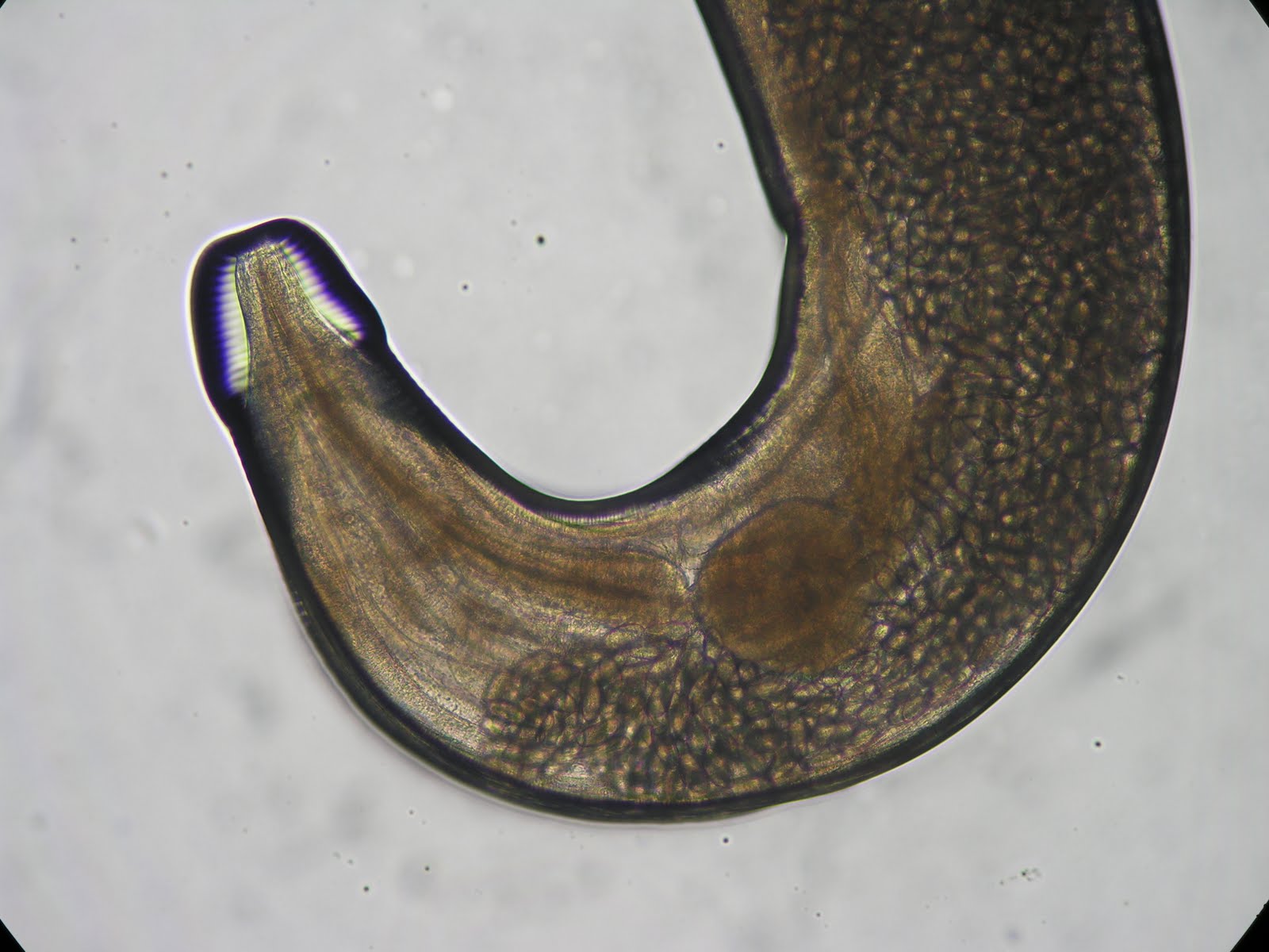Microbiologia Clinica: Test de Graham