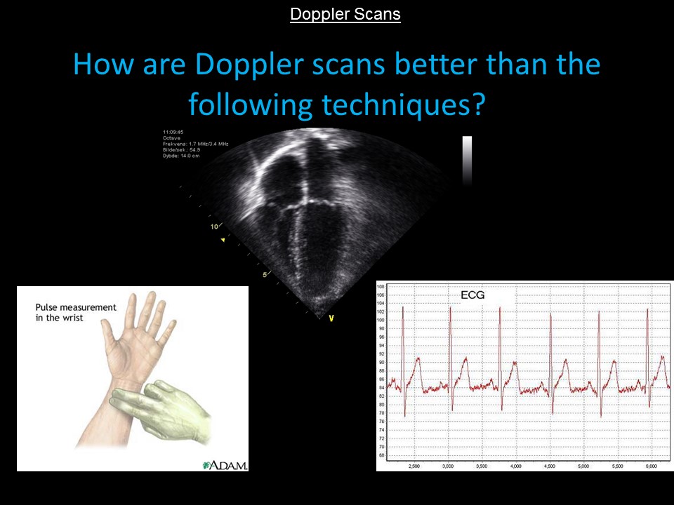 Mr Lloyd's Interactive Board: Doppler Effect, ultrasound, medical imaging