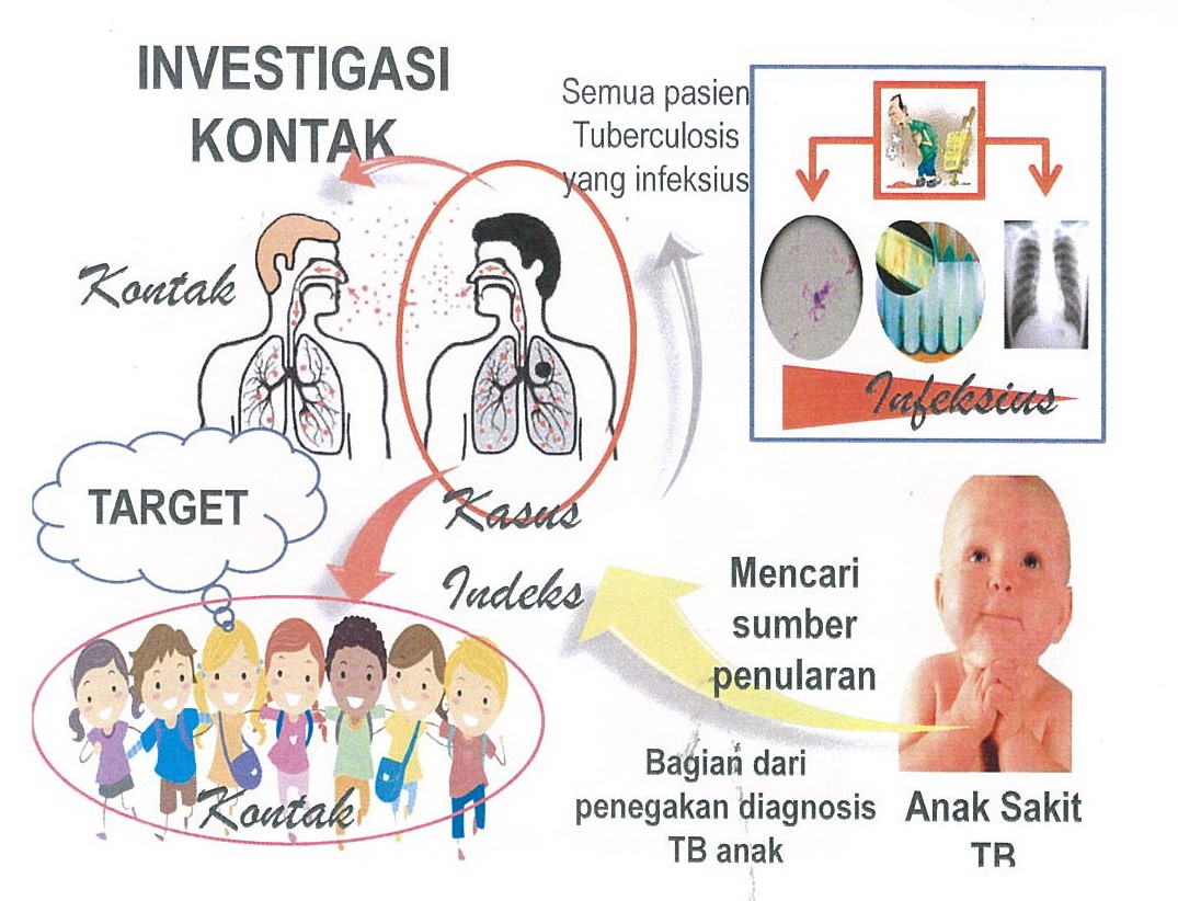 10 Cara Telaten Kenali dan Obati TB Laten - Opi Ardiani