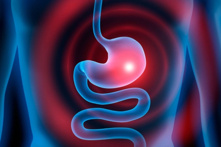 Acid Reflux Fact Sheet - GERD/ACID REFLUX INFORMATION