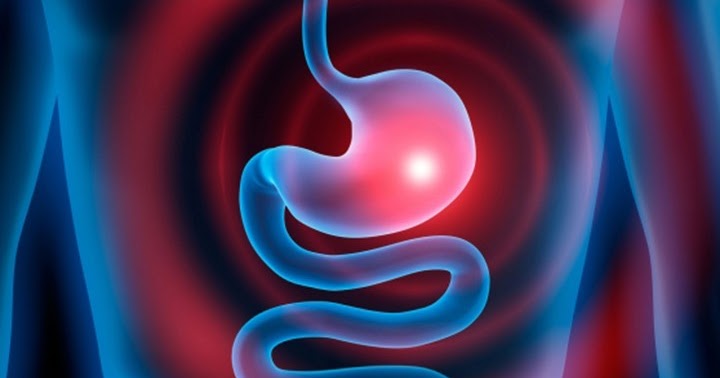 Acid Reflux Fact Sheet - GERD/ACID REFLUX INFORMATION