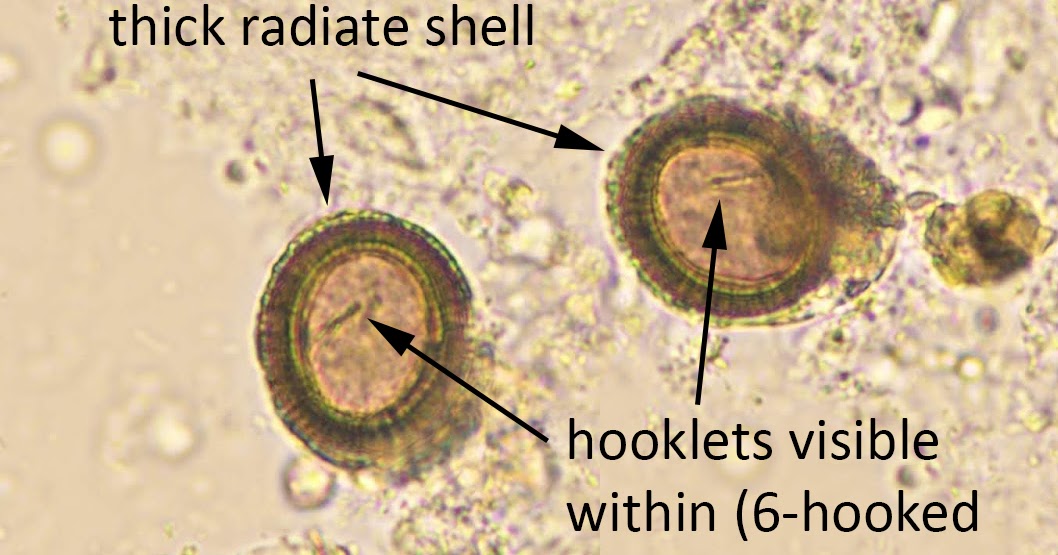 Creepy Dreadful Wonderful Parasites: Answer to Case 498