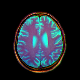 Nevit's blog: Color MRI of the Brain