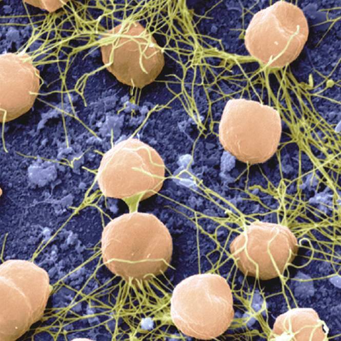 madressilva: Euriarqueotas