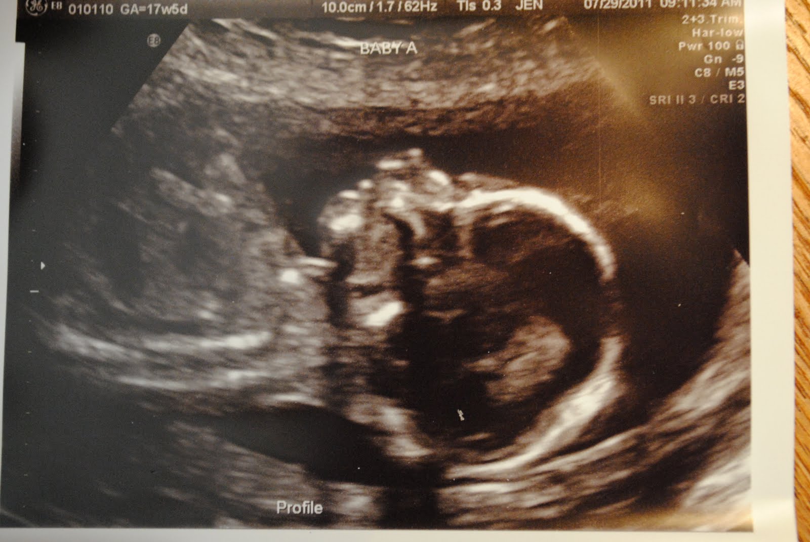 Babies Are Simple: 18 Weeks