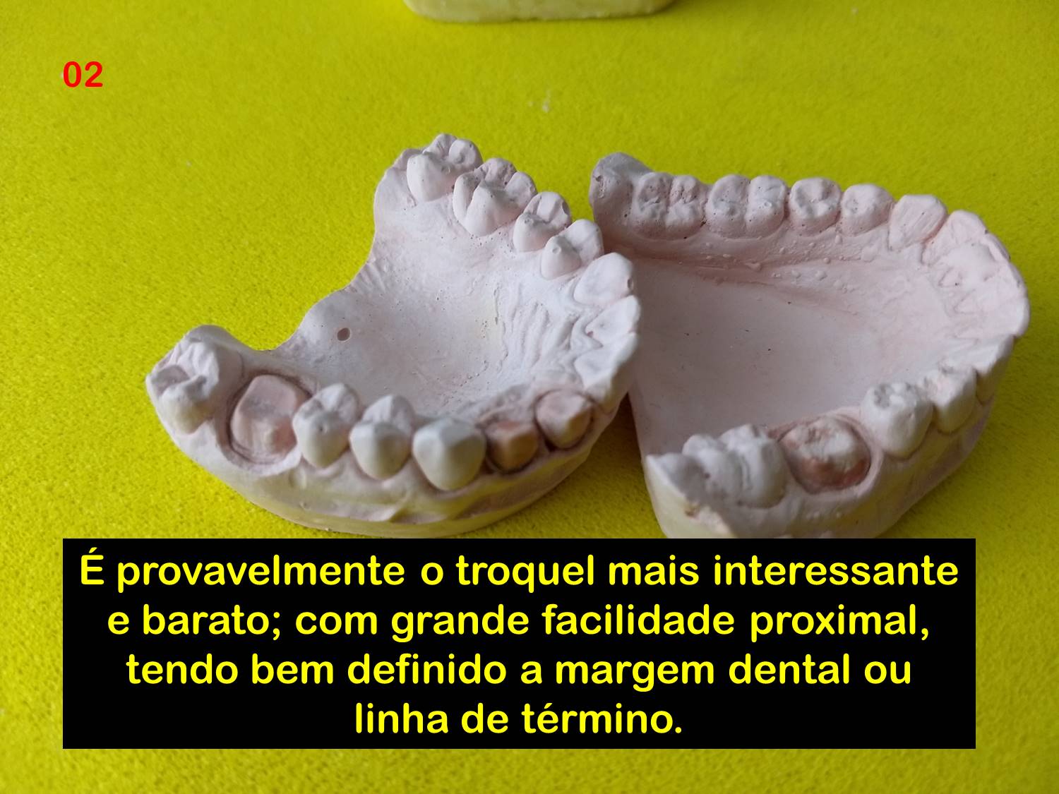 Professor Gilmar Zukowski gilmarprotese.blogspot.com : 3ºANO PF ...