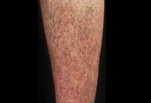 Skin Diseases | MEDICAL CHOICES