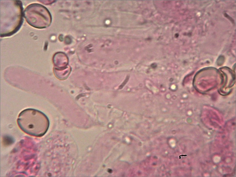Misidentifying Fungi: Ditchling Beacon Fungus Foray