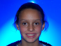 Truman Orthodontics: Unilateral Crossbite With a Functional Shift