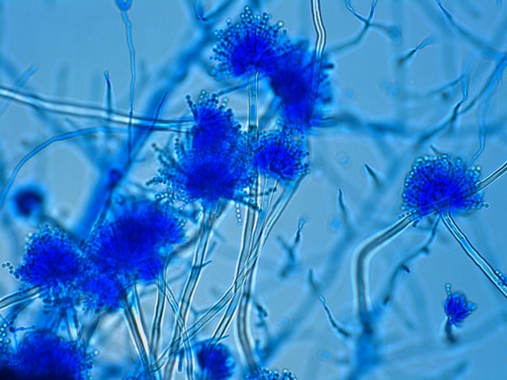 Fun With Microbiology (What's Buggin' You?): Aspergillus versicolor