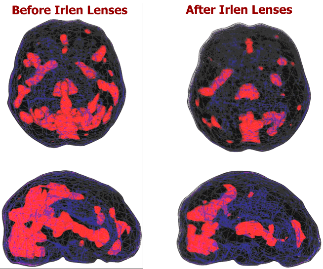 Ιστολόγιο Ειδικής Αγωγής ''ΕΚφρασις''