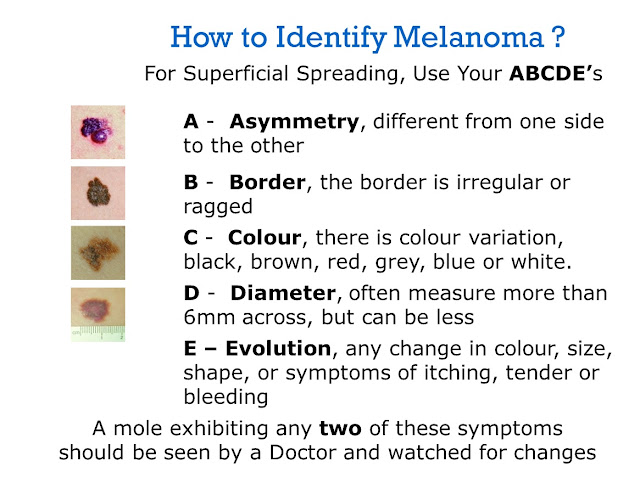 Mission "Melanoma": Melanoma Facts