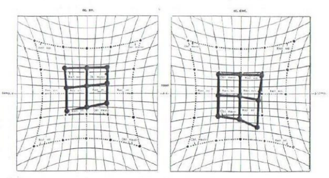 Test de Hess Lancaster
